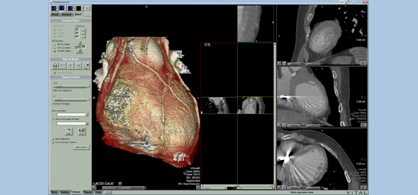 Cardiac MRI: It’s a Team Effort - Radiating Hope