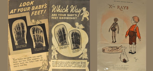 Radiology Through the Years - Radiating Hope