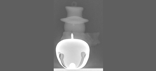 Holiday Ornaments X-posed - Radiating Hope