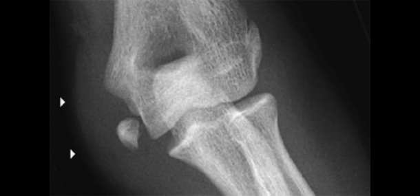 Condition and Stretch Young Bodies to Prevent Baseball Injuries ...