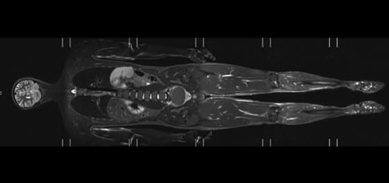 Whole-Body Imaging: From Head to Toe - Radiating Hope