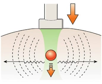 New Ultrasound Technology at Cincinnati Children's - Radiating Hope