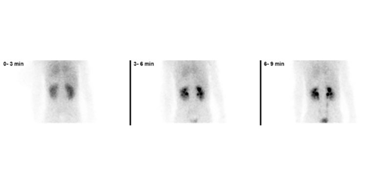 Facts About Nuclear Medicine You May Not Have Known - Radiating Hope