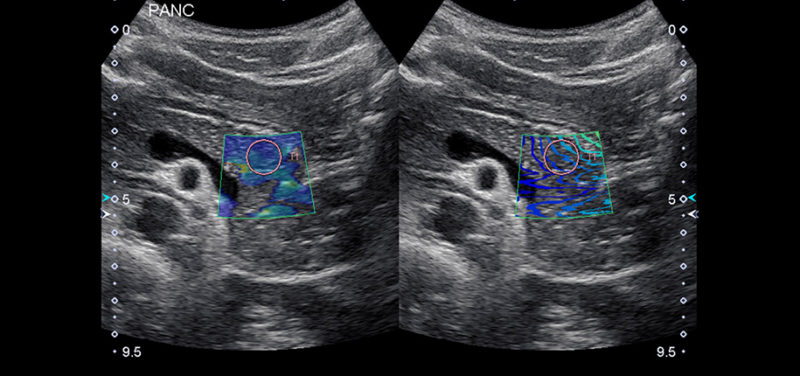 Cincinnati Children's Excels in Ultrasound Imaging - Radiating Hope