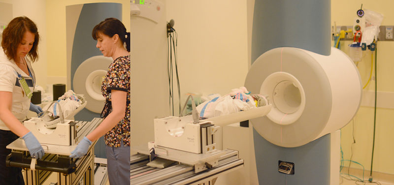 MRI Research of Bronchopulmonary Dysplasia in the NICU - Radiating Hope