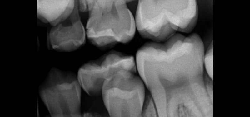 Odontogenesis, or The Formation of Teeth - Radiating Hope