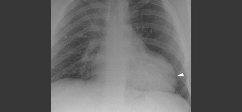 “Poetry” in Pediatric Radiology - Radiating Hope