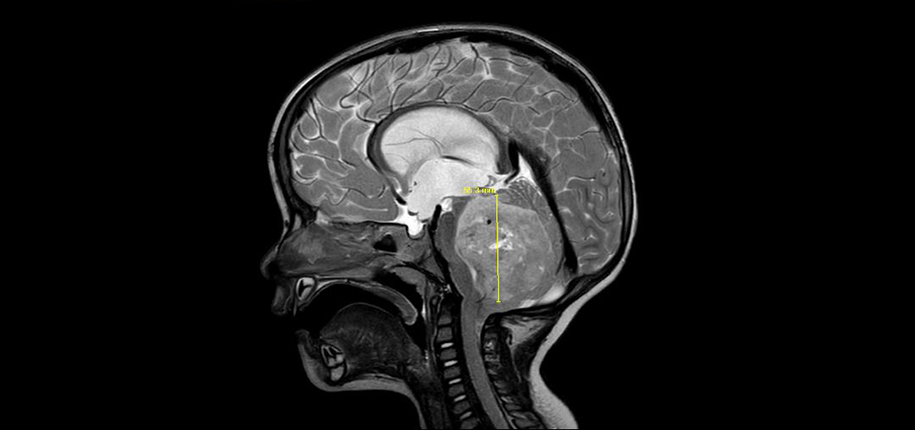 Is MRI Contrast Dangerous? - Radiating Hope