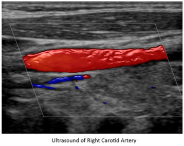 Imaging Blood Vessels - Radiating Hope