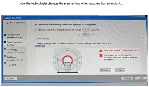 MRI Safety, Implants, Image Effects, and More - Radiating Hope