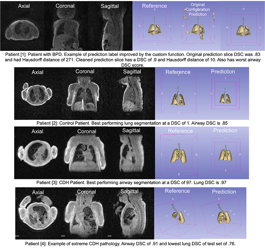 Advancing Neonatal Imaging: Cincinnati Children’s AI Imaging Research ...